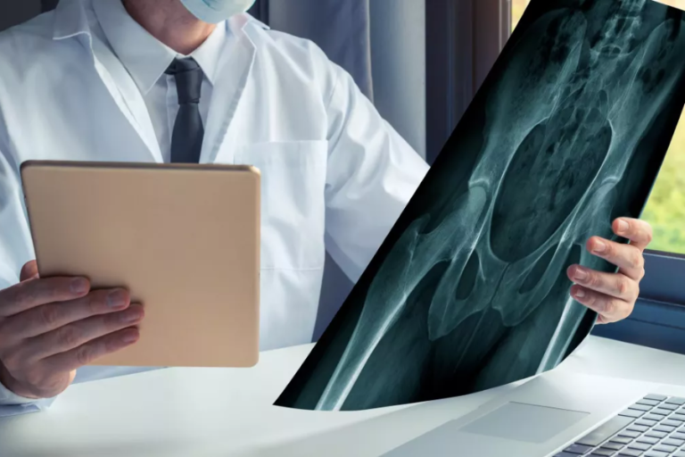 Traitement du cancer des os - Anadolu Medical Center | Your Health ...